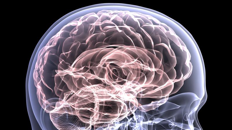 New imaging tool to scan for common brain disorders | New imaging tool ...