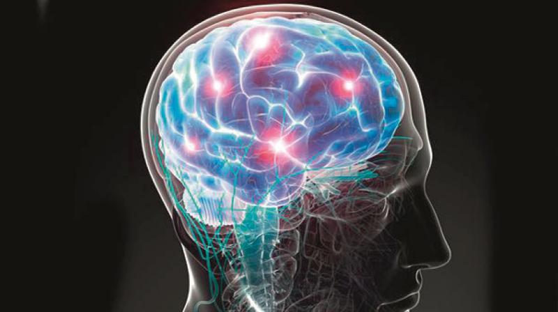 Rebooting the brain: Bringing the dead back to life' | Rebooting the ...